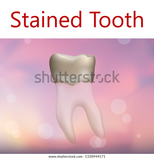 Stained Tooth Vector Realistic Anatomy Illustration Stock Vector ...