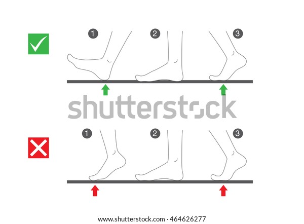 Step Walk Properly Illustration About Medical Stock Vector (Royalty ...