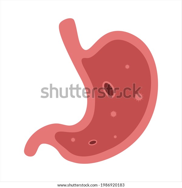 Stomach Ulcer Bacteria Vector Flat Cartoon Stock Vector (Royalty Free ...