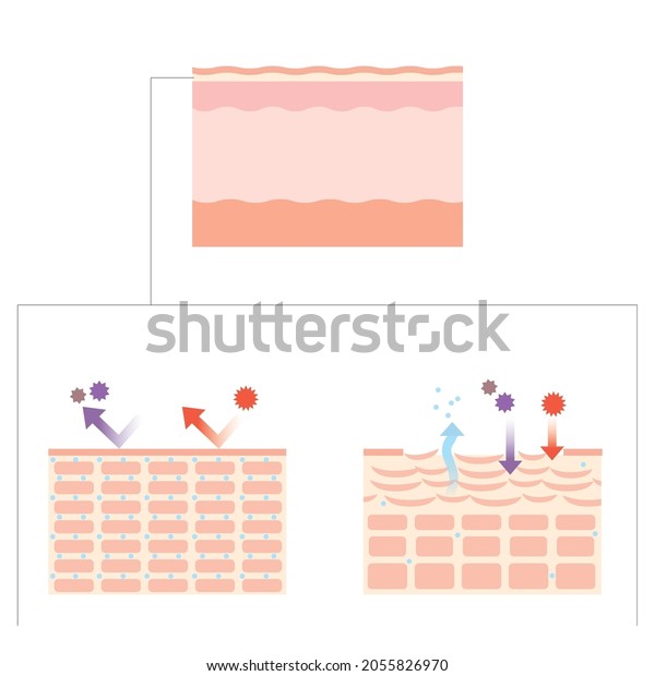 Stratum Corneum Skin Structure Skin Skin Stock Vector Royalty Free