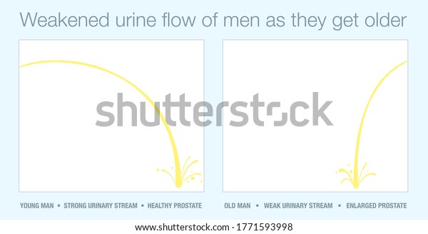 Strong Urine Stream Young Man Healthy Stock Vector (Royalty Free ...