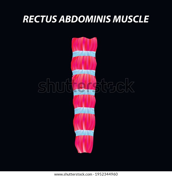 Structure Skeletal Muscle Rectus Abdominis Muscle: stockvector ...