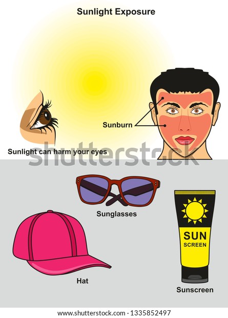 Sunlight Exposure Infographic Diagram Showing How Immagine Vettoriale