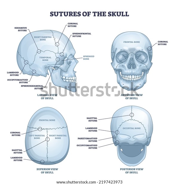 18 Sphenofrontal Images, Stock Photos & Vectors | Shutterstock