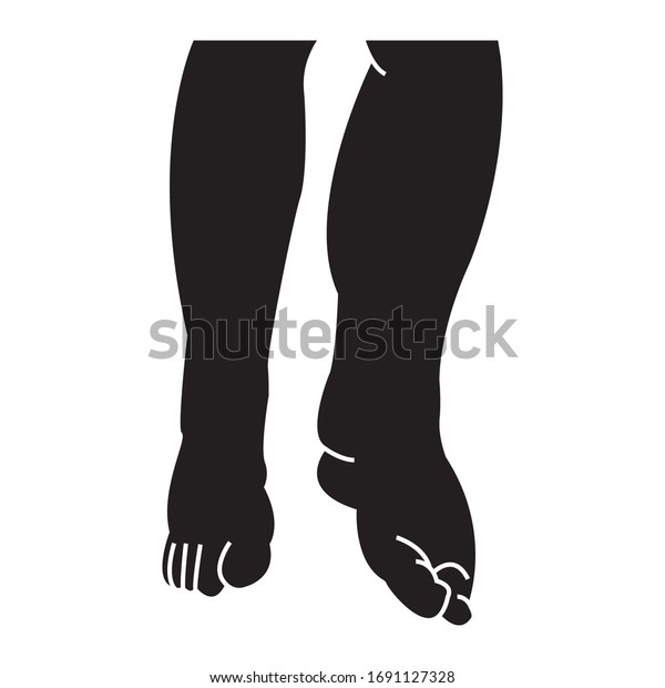 Swollen Foot Ankle Leg Concept Vector Stock Vector (Royalty Free ...