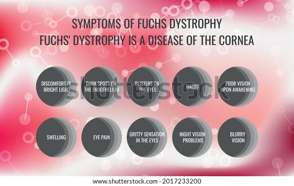 Symptoms Fuchs Dystrophy Vector Illustration Medical Stock Vector ...