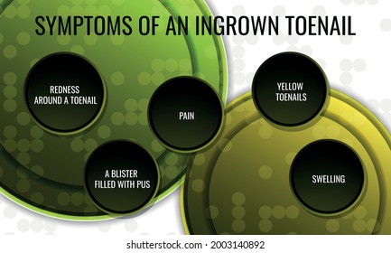 Symptoms Ingrown Toenail Vector Illustration Medical Stock Vector ...