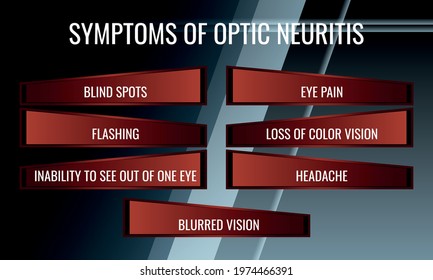93 Optic neuritis Images, Stock Photos & Vectors | Shutterstock