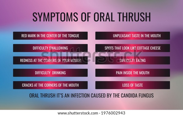 Vektor Stok Symptoms Oral Thrush Vector Illustration Medical (Tanpa ...