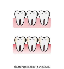 Teeth Good Bad Teeth Vector Illustration Stock Vector (Royalty Free ...