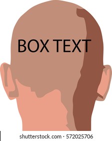 Text Box Bald Head Stock Vector (Royalty Free) 572025706