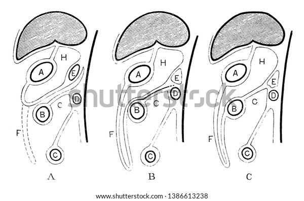 This Diagram Represents Development Great Omentum Stock Vector (Royalty ...