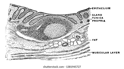 275 Vermiform appendix Images, Stock Photos & Vectors | Shutterstock