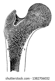Femur Images, Stock Photos & Vectors | Shutterstock