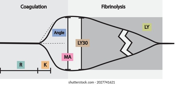 Thromboelastography Teg Blood Coagulation Analysis Chart: เวกเตอร์สต็อก ...