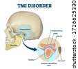 Tmj Disorder Royalty-Free Images, Stock Photos & Pictures | Shutterstock