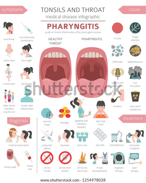 Vector de stock (libre de regalías) sobre Tonsils Throat Diseases ...