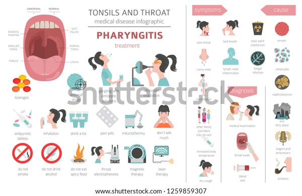 Tonsils Throat Diseases Pharyngitis Symptoms Treatment Stock Vector ...