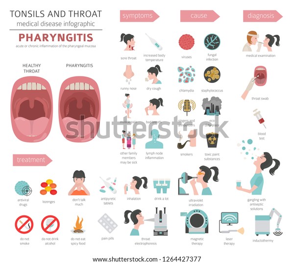 Tonsils Throat Diseases Pharyngitis Symptoms Treatment: stockvector ...