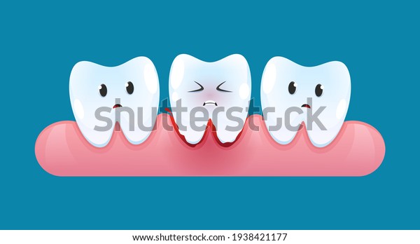 Tooth Bleeding Gum Blood Teeth Vector Stock Vector (Royalty Free ...