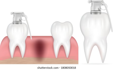 99 Grenade teeth Images, Stock Photos & Vectors | Shutterstock