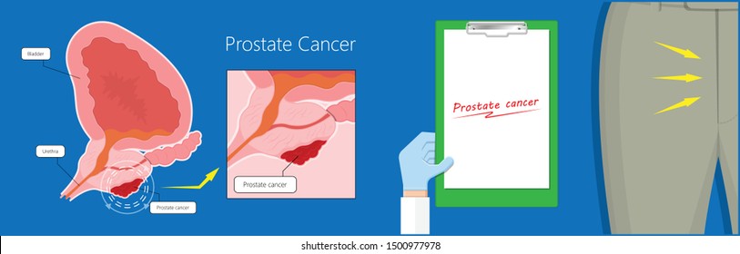Cystoscopy Images, Stock Photos & Vectors | Shutterstock
