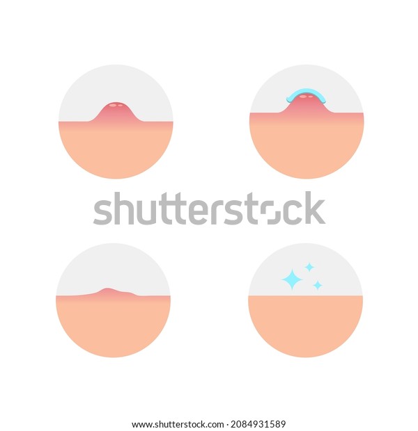 153 Anti Inflammatory Skin Stock Vectors, Images & Vector Art ...