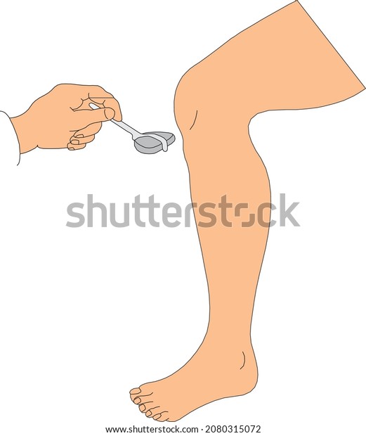 Triceps Reflex Examination Neurological Hammer Basic Stock Vector ...