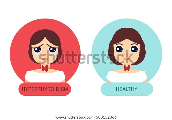 Two Women Hyperthyroid Normal Gland Made Stock Vector (Royalty Free ...