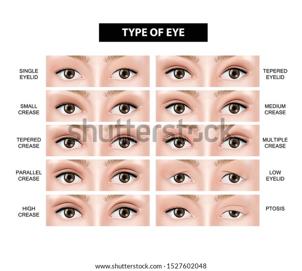 Type Eyelid Crease Vector Illustration Stock Vector (Royalty Free ...