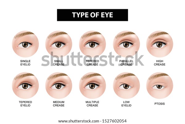 Type Eyelid Crease Vector Illustration Stock Vector (Royalty Free ...