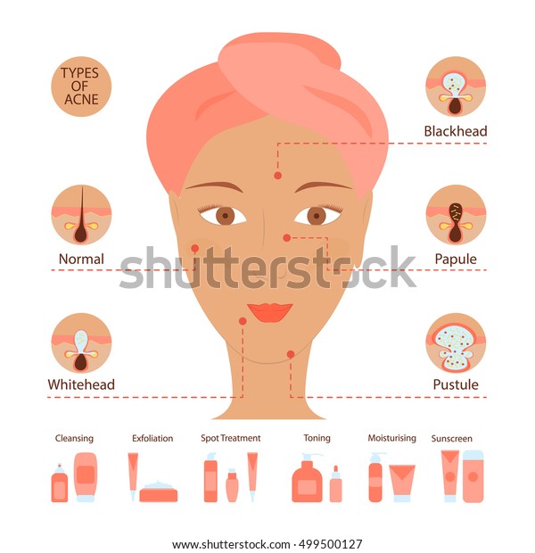 Types Acne Pimples Human Skin Poster Stock Vector (Royalty Free) 499500127