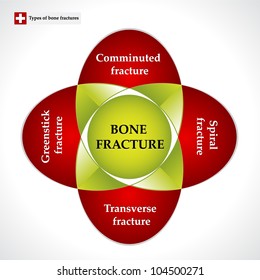 Types Bone Fractures Colorful Chart Stock Vector (Royalty Free ...