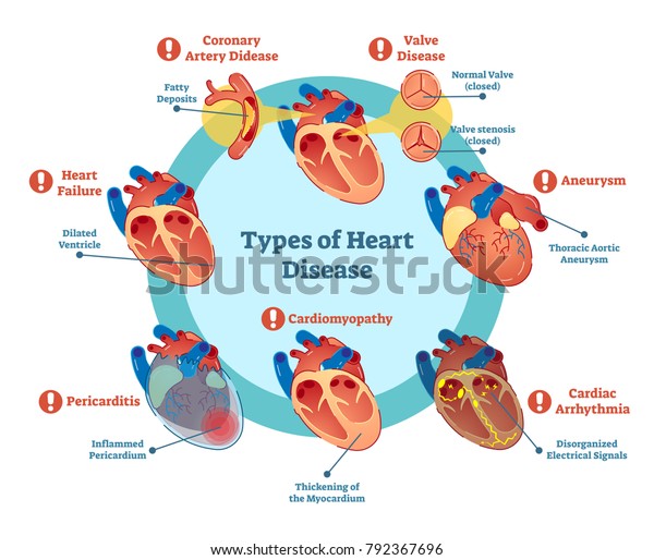 Types Heart Disease Collection Vector Illustration Stock-vektor ...