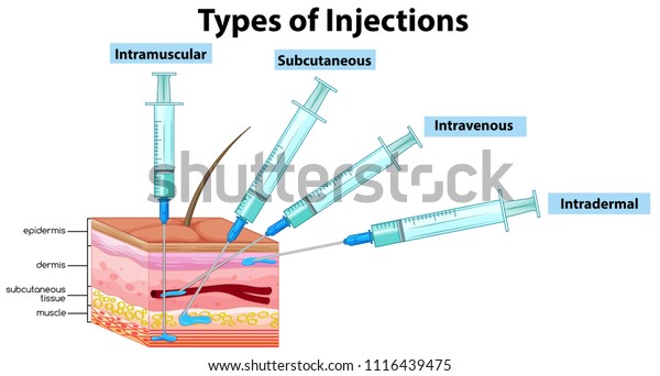 Tipos de inyecciones en fondo blanco