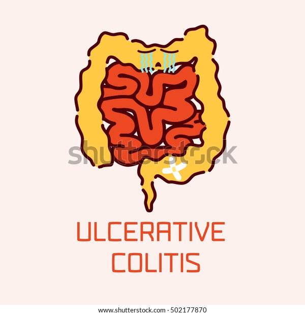 Ulcerative colitis awareness poster with sad cartoon intestine on white ...