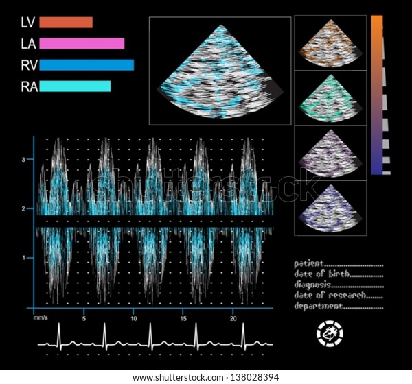 Ultrasound Screen Echocardiogram Phonocardiogram Electrocardiogram ...