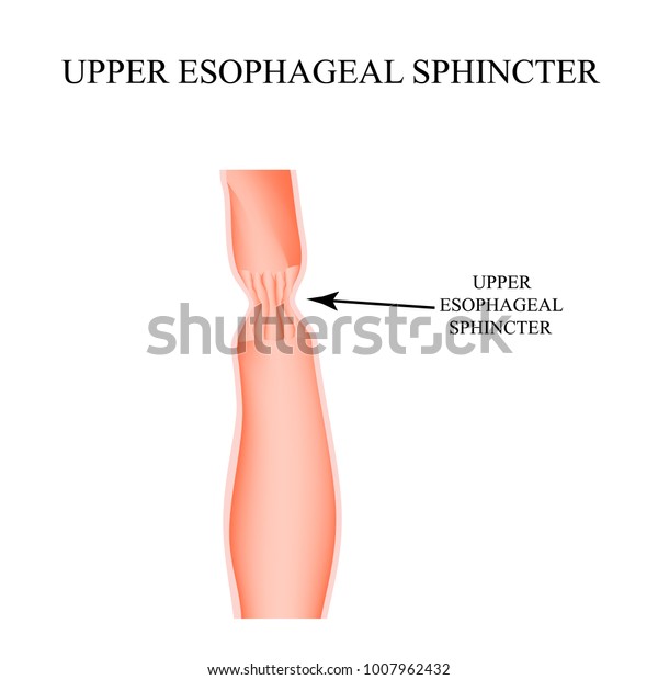 Upper Sphincter Esophagus Infographics Vector Illustration Stock Vector ...