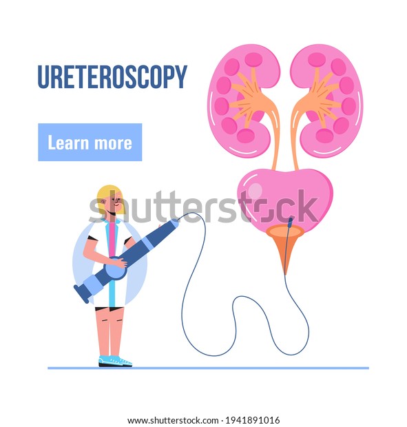 69 Ureteroscopy Images, Stock Photos & Vectors | Shutterstock