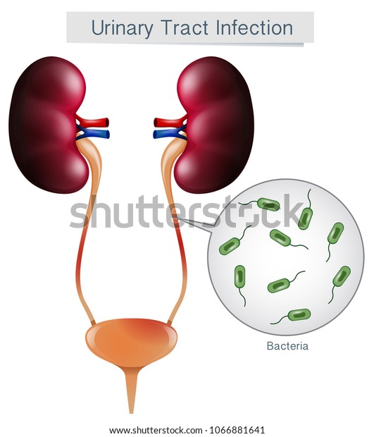 1,647 Urinary Tract Vector Images, Stock Photos & Vectors | Shutterstock