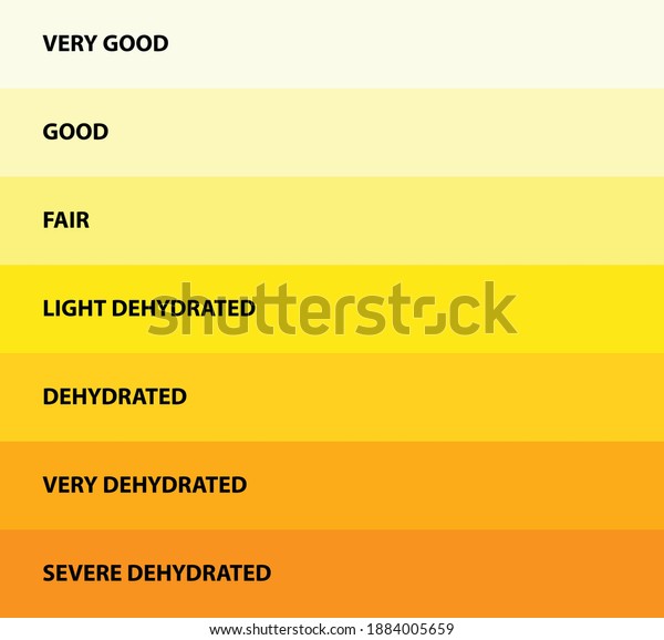 Urine Color Dehydration Urine Color Chart Stock Vector (Royalty Free ...