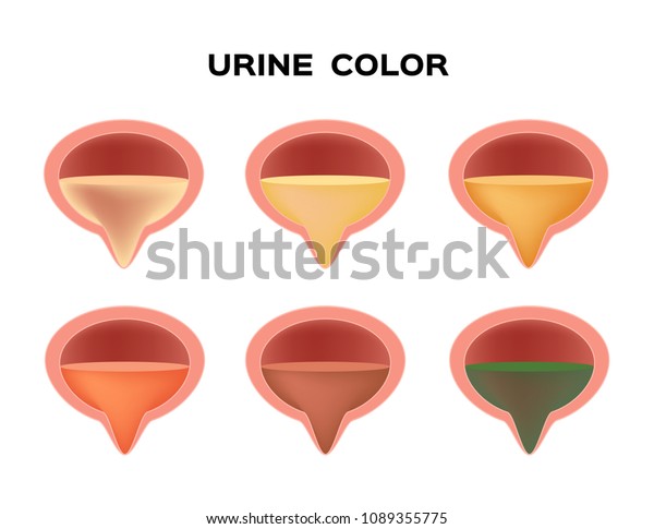 Urine Color Vector Transparent Yellow Red Stock Vector (Royalty Free ...