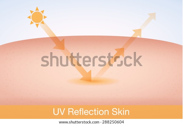 Uv Reflection Skin After Protection Skin Stock Vector (Royalty Free ...