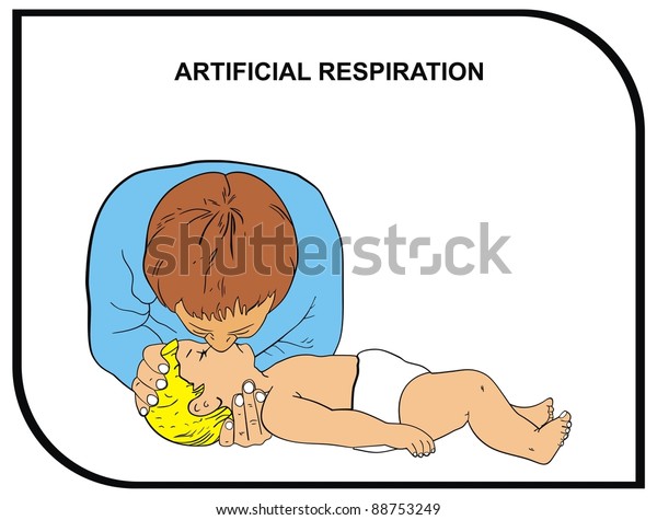 Vector Artificial Respiration Baby Stock Vector (Royalty Free) 88753249