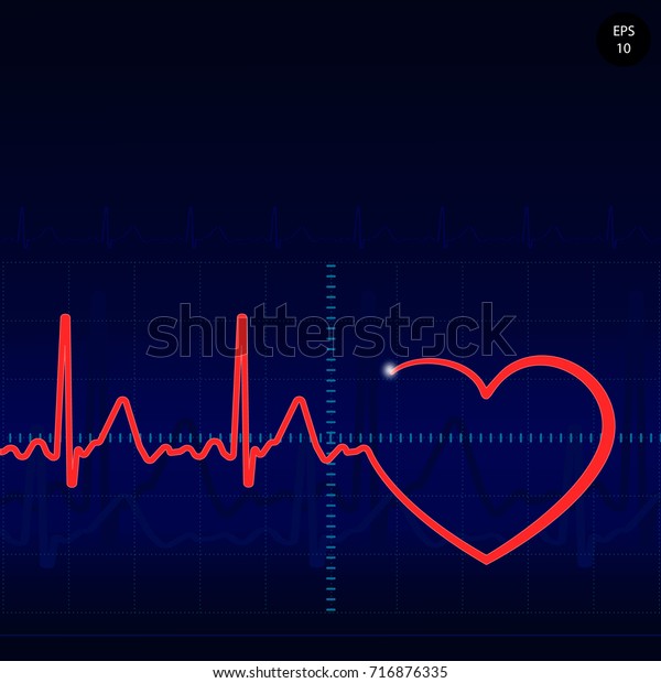Vector Cardiology Illustration Pulse Rate Diagram Stock Vector (Royalty ...