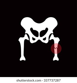 1,436 Hip fracture icon Images, Stock Photos & Vectors | Shutterstock