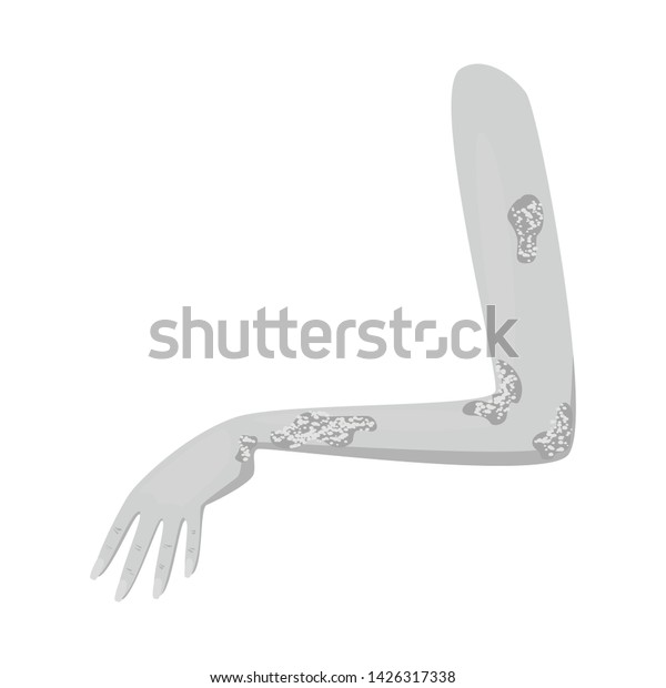 Vector Design Psoriasis Dermatitis Icon Set Stock Vector Royalty Free