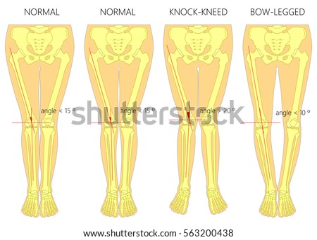 Vector Diagram Shapes Legs Normal Curved Stock Vector (Royalty Free ...