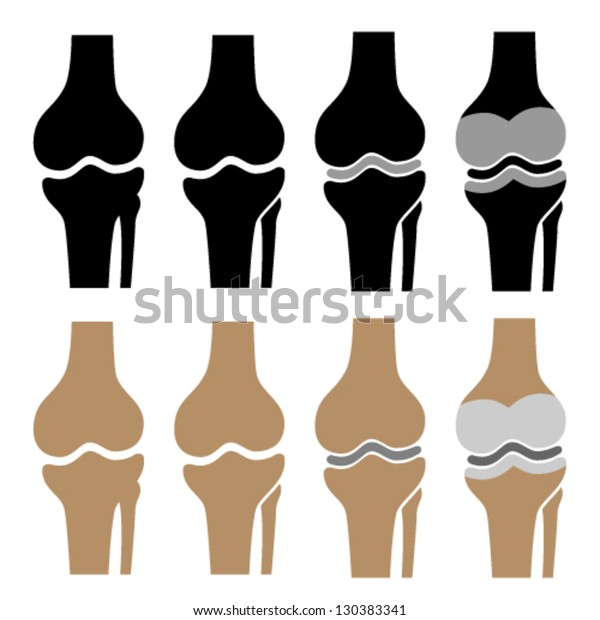 Vector Human Knee Joint Symbols Stock Vector (Royalty Free) 130383341