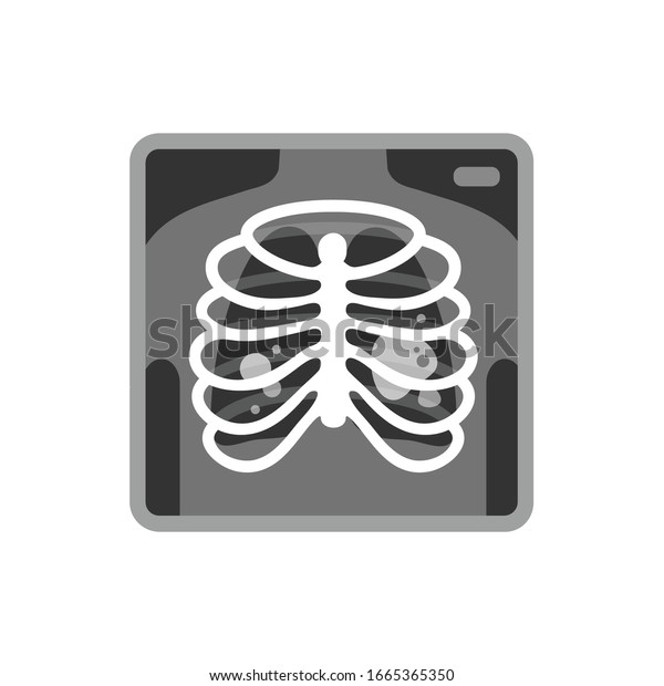Vector Illustration Chest Xray Image Lung Stock Vector (Royalty Free ...